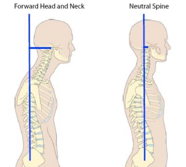 Back, Neck, Shoulder & Elbow Pain When Working From Home | Central ...