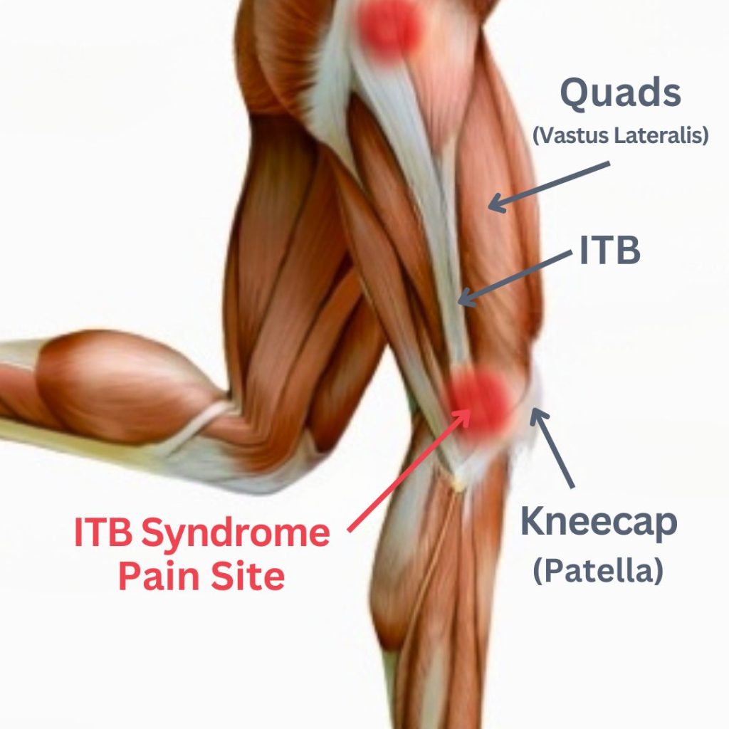 ITB Syndrome In Runners - What Works? | Central Performance