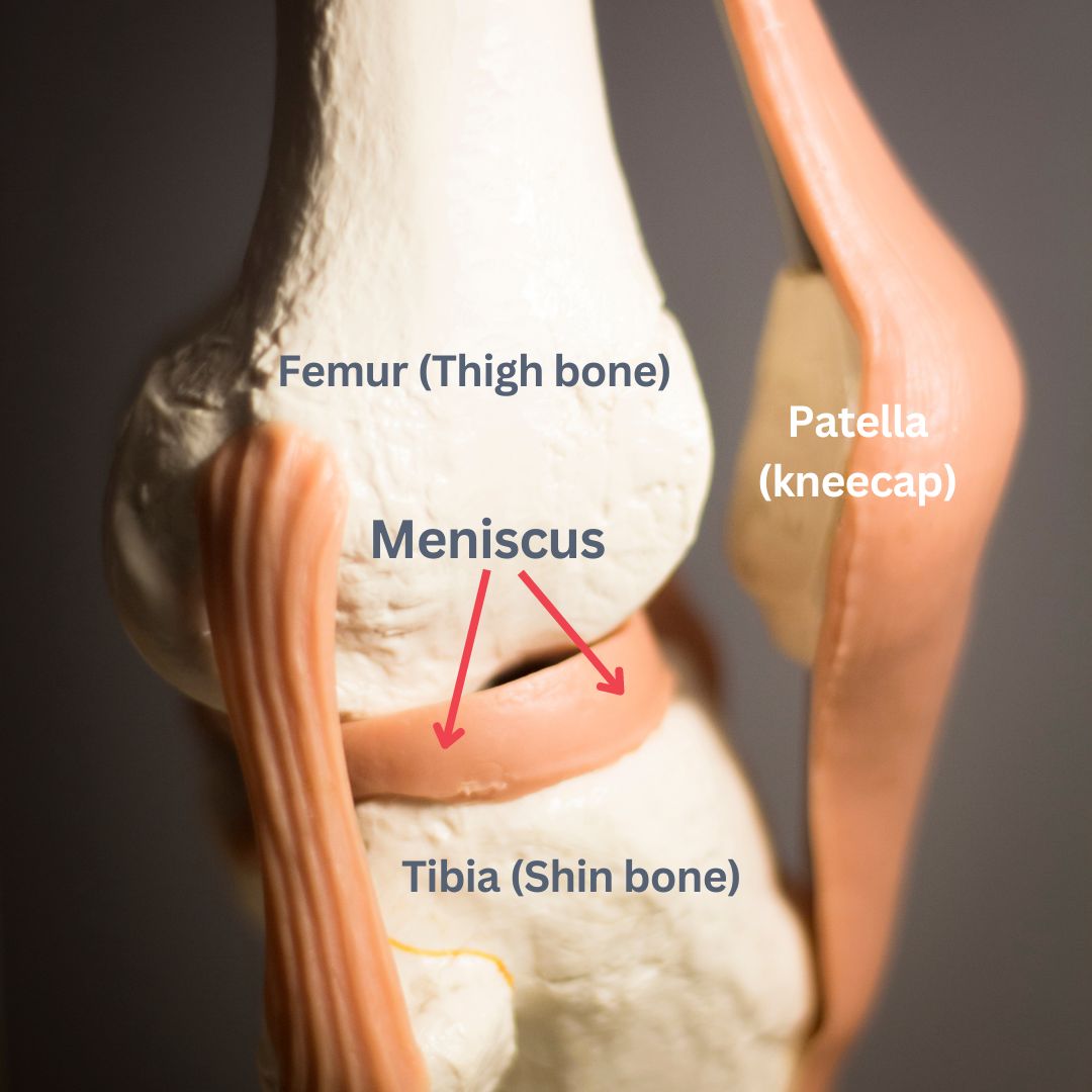 Knee Physio Sydney CBD/ Surry Hills | Central Performance