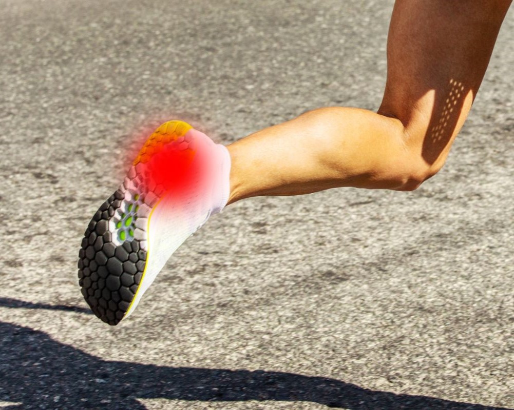 Heel Pain With Running - What to Do? | Central Performance